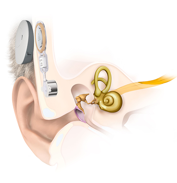 Jordan Hearing Aids Announces – hearingtec